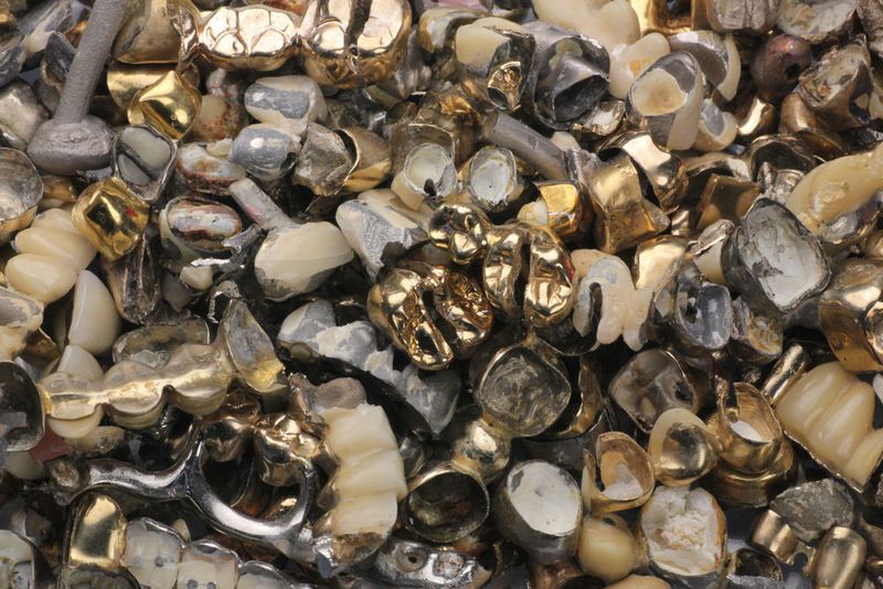 Zahngold Ankauf, Zahngold verkaufen, Goldkronen Ankauf | ESG Gold-Ankauf.de